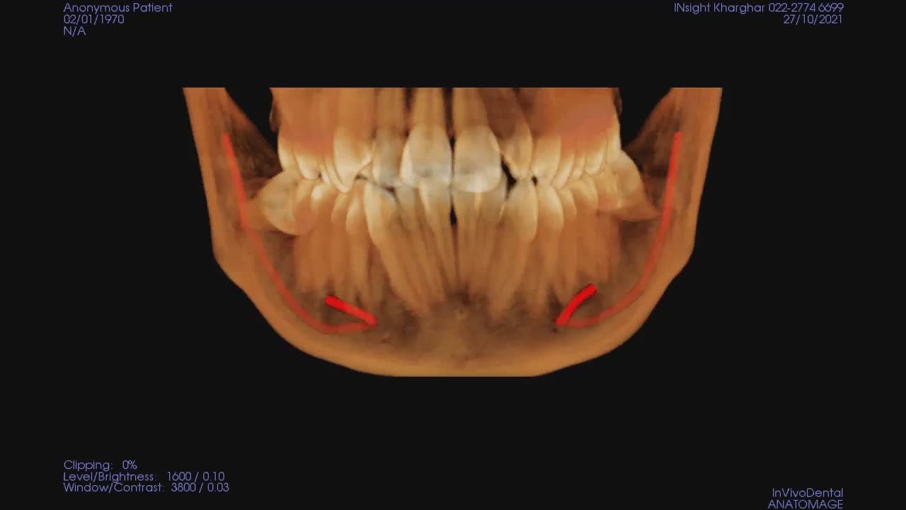 Insight CBCT Diagnostic Centre in Vashi,Navi Mumbai - Diagnostic ...