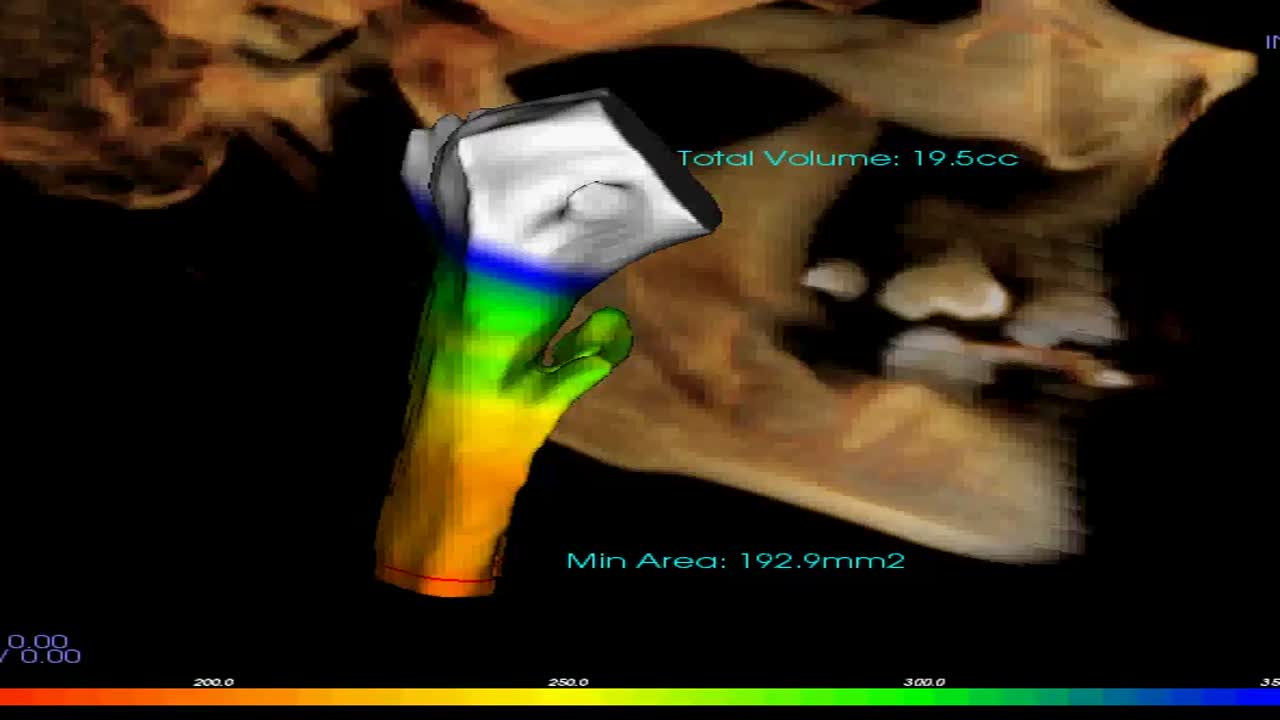 Insight CBCT Diagnostic Centre in Bandra West,Mumbai - Diagnostic ...