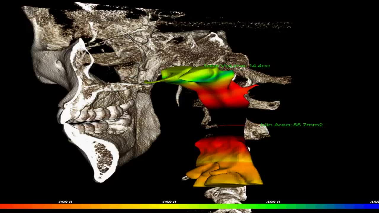 Insight CBCT Diagnostic Centre in Bandra West,Mumbai - Diagnostic ...